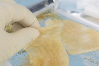 Are You a Wound Care Detective? | Wound Scene Investigation: Series ...